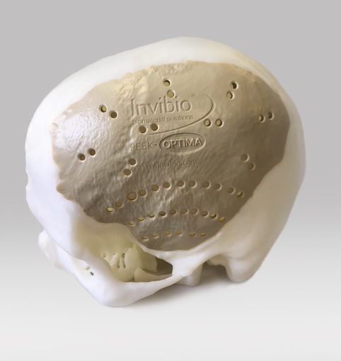 CMF & Sternal Fixation Solutions - Invibio