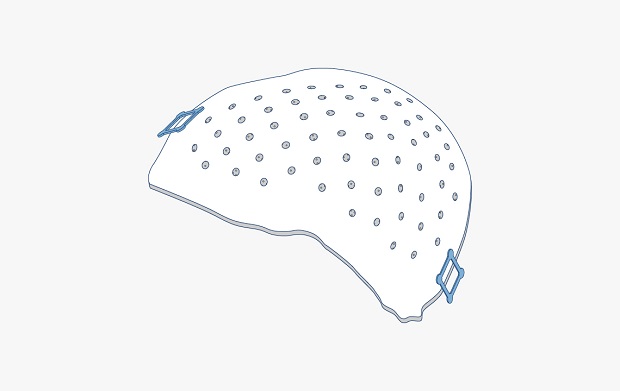 Transforming Trauma with Polymer Composites - Invibio