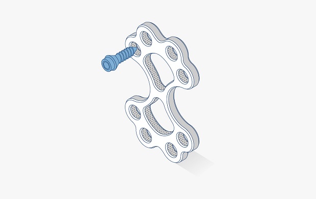 Transforming Trauma with Polymer Composites - Invibio